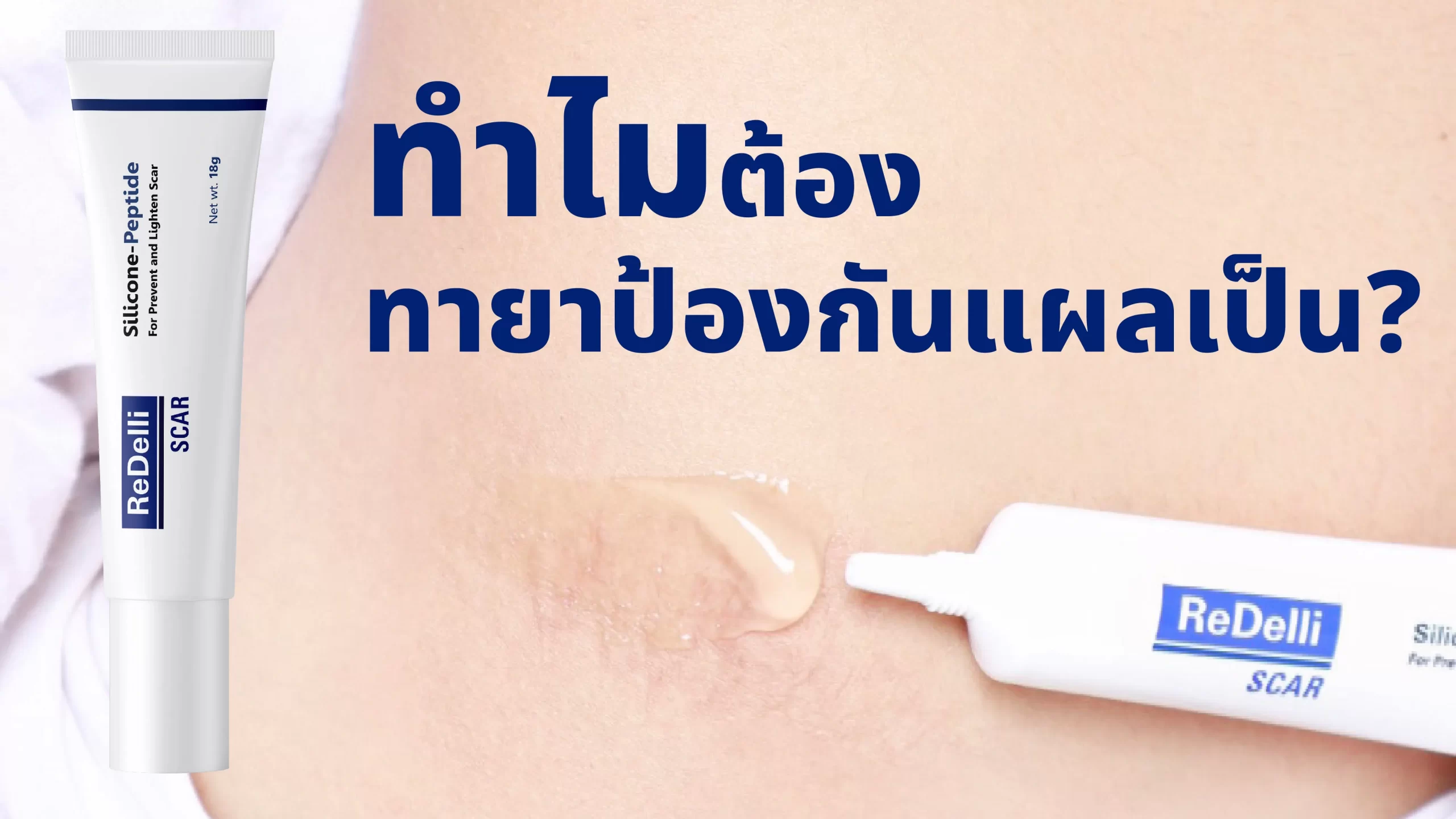 ทายาป้องกันแผลเป็นตั้งแต่เนิ่นๆ ก่อนเป็นรอยแผลเป็น! - ReDelli